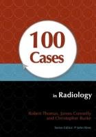 100 Cases in Radiology - Connelly James | Książka w Empik