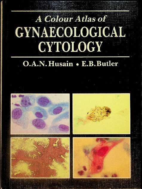 A Colour Atlas of Gynaecological Cytology - Opracowanie zbiorowe ...