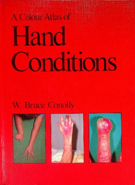 A Colour Atlas of Hand Conditions - Opracowanie zbiorowe | Książka w Empik