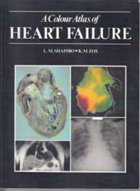 A Colour Atlas of Heart Failure - Opracowanie zbiorowe | Książka w Empik