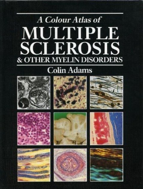 A Colour Atlas of Multiple Sclerosis and Other Myelin Disorders - Colin ...