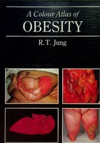 A Colour Atlas of Obesity. - Opracowanie zbiorowe | Książka w Empik