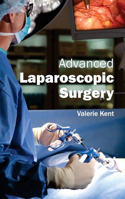 Advanced Laparoscopic Surgery - M L Books International Pvt Ltd ...