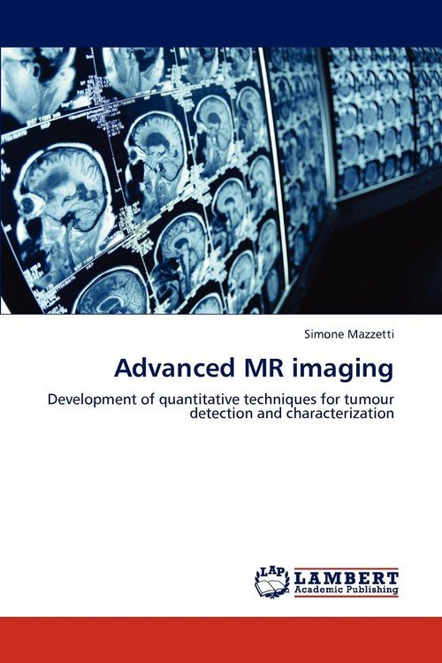 Advanced MR Imaging - Mazzetti Simone | Książka w Empik