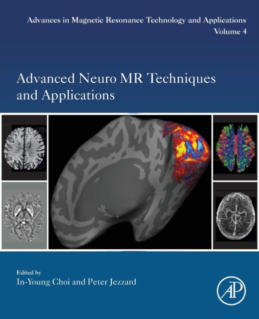 Advanced Neuro MR Techniques and Applications - Opracowanie zbiorowe ...