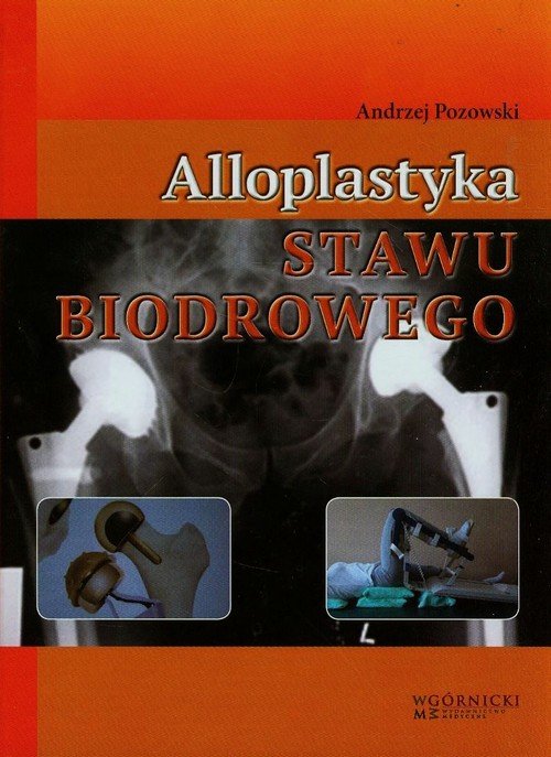 Alloplastyka stawu biodrowego - Pozowski Andrzej | Książka w Empik