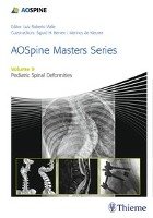 AOSpine Masters Series, Volume 9: Pediatric Spinal Deformities - Thieme ...