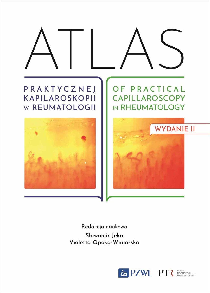 Atlas praktycznej kapilaroskopii w reumatologii. Atlas of practical ...