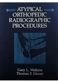 Atypical orthopedic radiographic procedures - Opracowanie zbiorowe ...