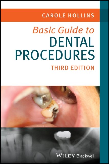 Basic Guide Dentistry Series, Basic Guide to Dental Procedures - Carole ...