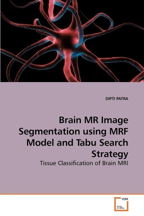 Brain MR Image Segmentation using MRF Model and Tabu Search Strategy ...
