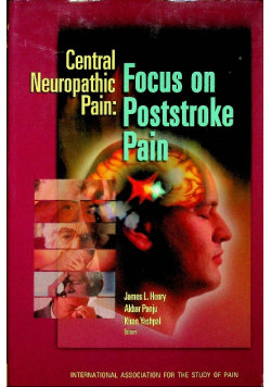Central Neuropathic Pain Focus on Poststroke Pain - Opracowanie ...