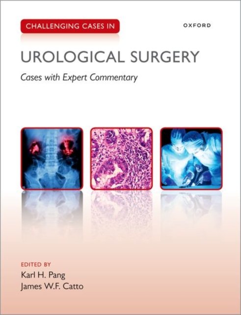 Challenging Cases in Urological Surgery - Oxford University Press ...