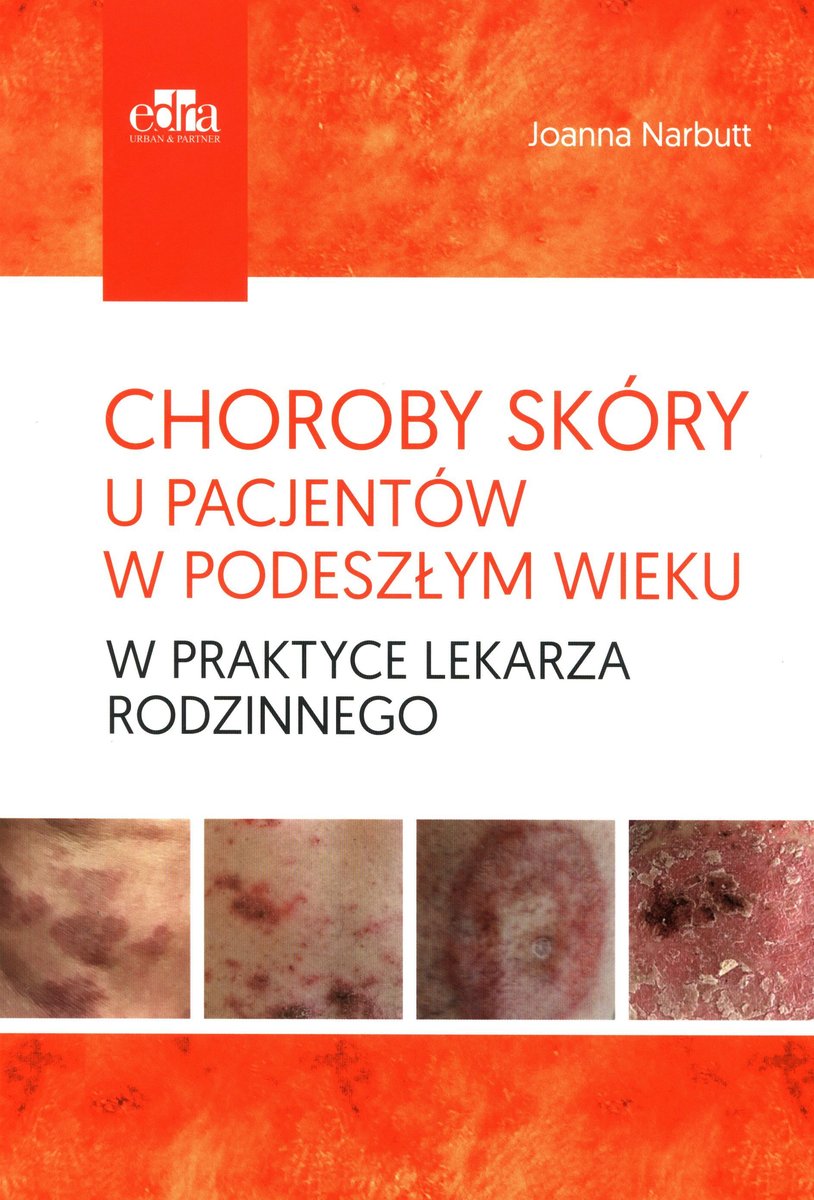 Choroby skóry u pacjentów w podeszłym wieku w praktyce lekarza ...