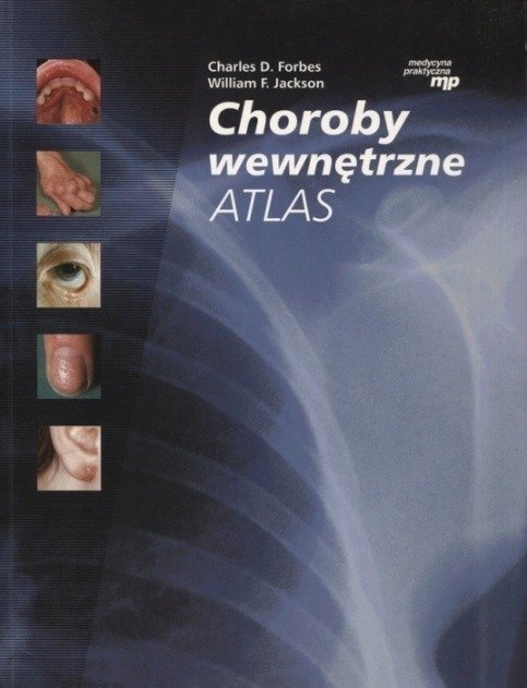 Choroby wewnętrzne atlas - Opracowanie zbiorowe | Książka w Empik