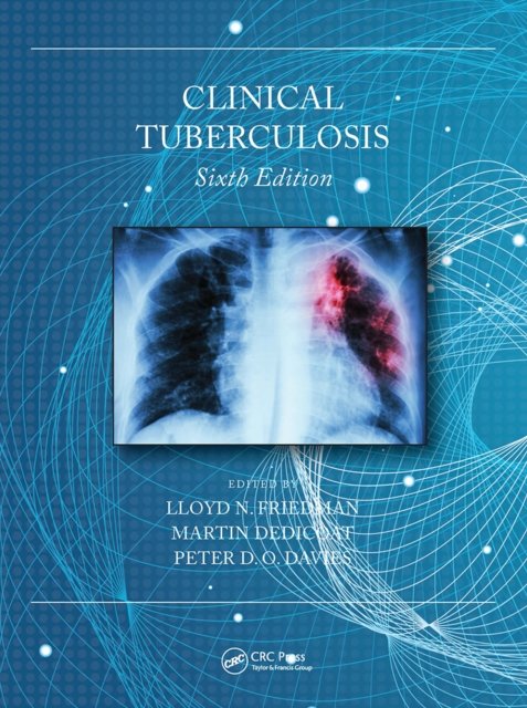 Clinical Tuberculosis - Opracowanie zbiorowe | Książka w Empik