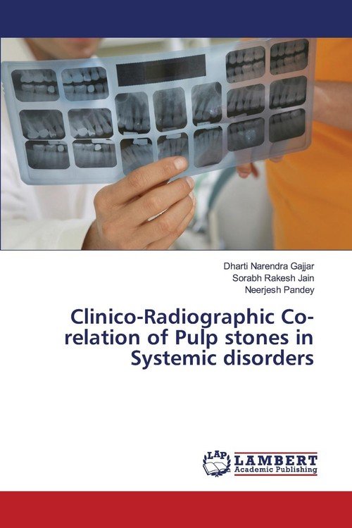 Clinico-Radiographic Co-relation of Pulp stones in Systemic disorders ...