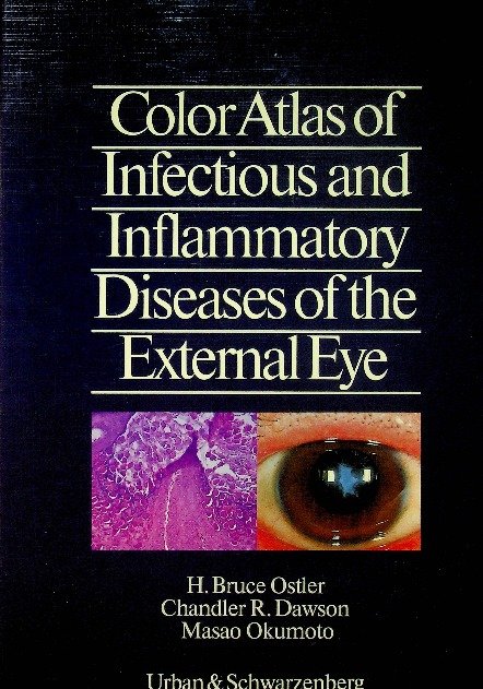 Color Atlas of Infectious and Inflammatory Diseases of the External Eye ...