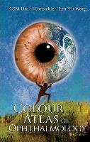 Colour Atlas Of Ophthalmology (Fifth Edition) - Tien Yin Wong | Książka ...