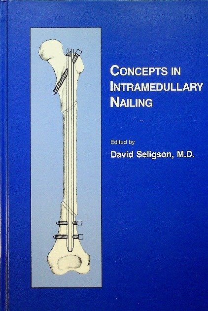 Concepts in Intramedullary Nailing - Opracowanie zbiorowe | Książka w Empik