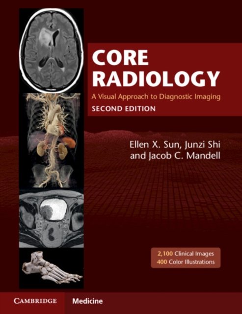 Core Radiology. A Visual Approach to Diagnostic Imaging - Opracowanie ...