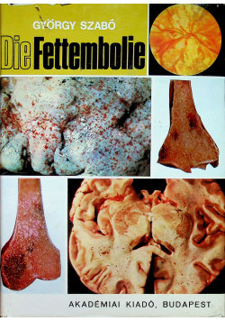 Die Fettembolie - | Książka w Empik