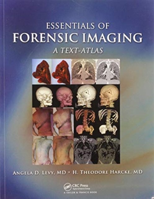 Essentials of Forensic Imaging: A Text-Atlas - Angela D. Levy | Książka ...