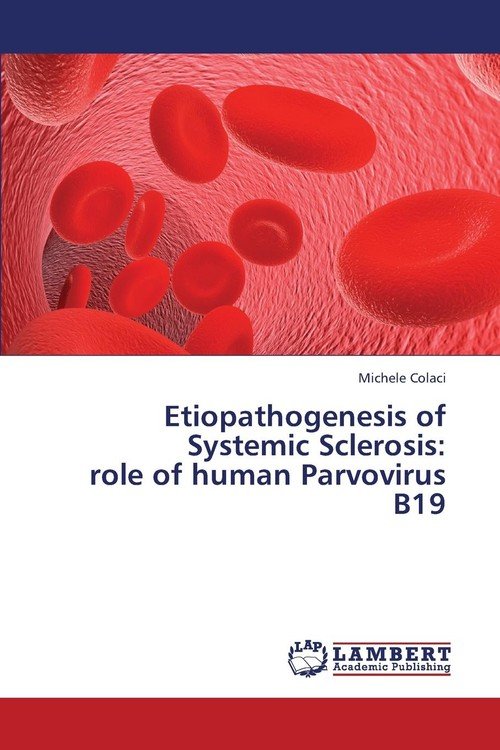 Etiopathogenesis of Systemic Sclerosis - Colaci Michele | Książka w Empik