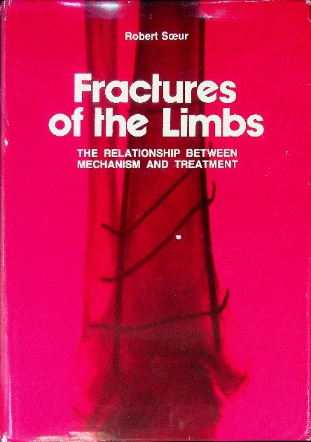 Fractures of the Limbs. The relationship between mechanism and ...