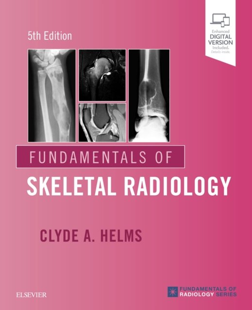 Fundamentals of Skeletal Radiology - Clyde Helms | Książka w Empik