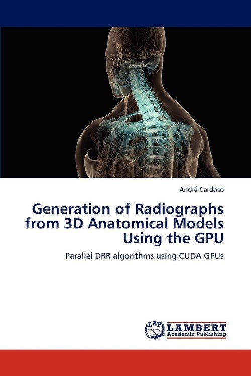 Generation of Radiographs from 3D Anatomical Models Using the GPU ...