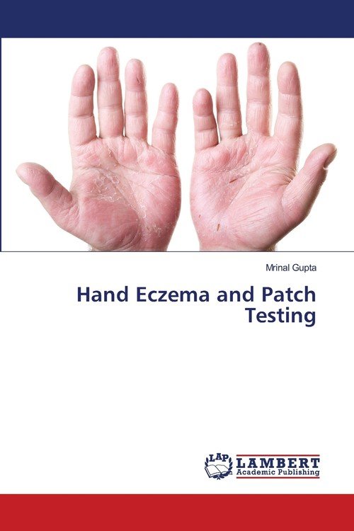 Hand Eczema and Patch Testing - Gupta Mrinal | Książka w Empik