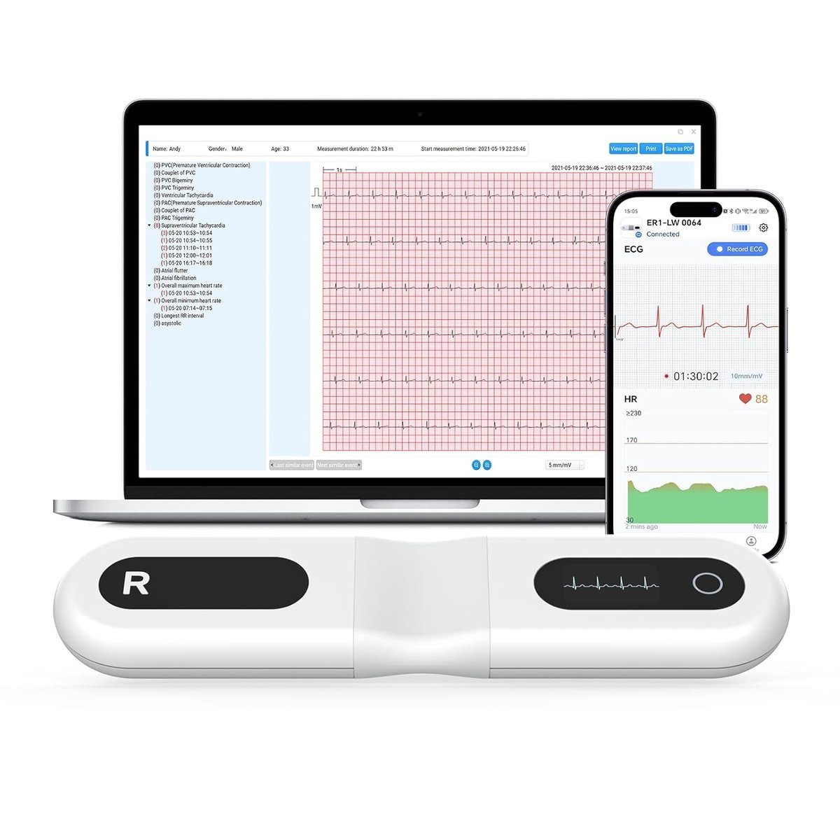 Holter EKG ER1-LW 24h – całodobowe monitorowanie pracy serca - Wellue ...