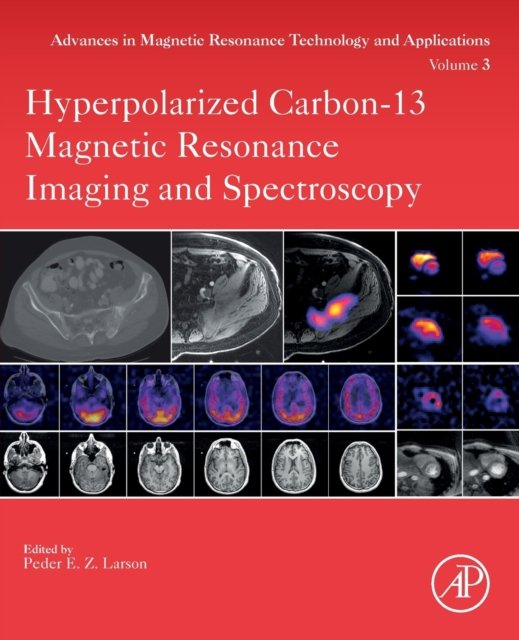 Hyperpolarized Carbon-13 Magnetic Resonance Imaging and Spectroscopy ...