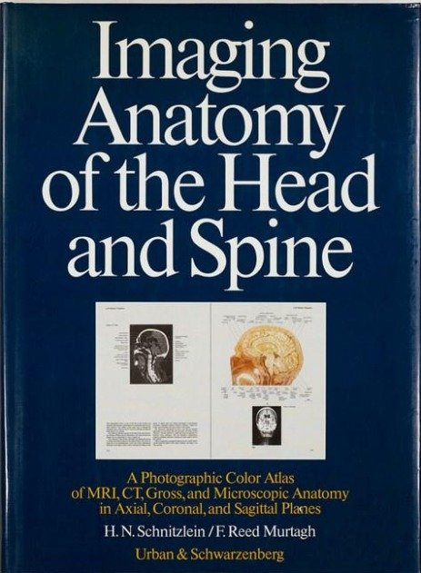 Imaging anatomy of the head and spine - Opracowanie zbiorowe | Książka ...