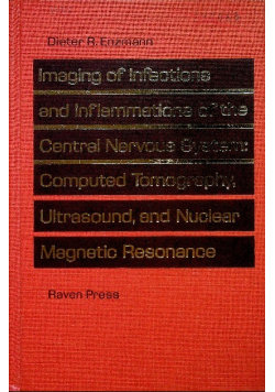 Imaging of infections and Inflammations of the central nervous system ...