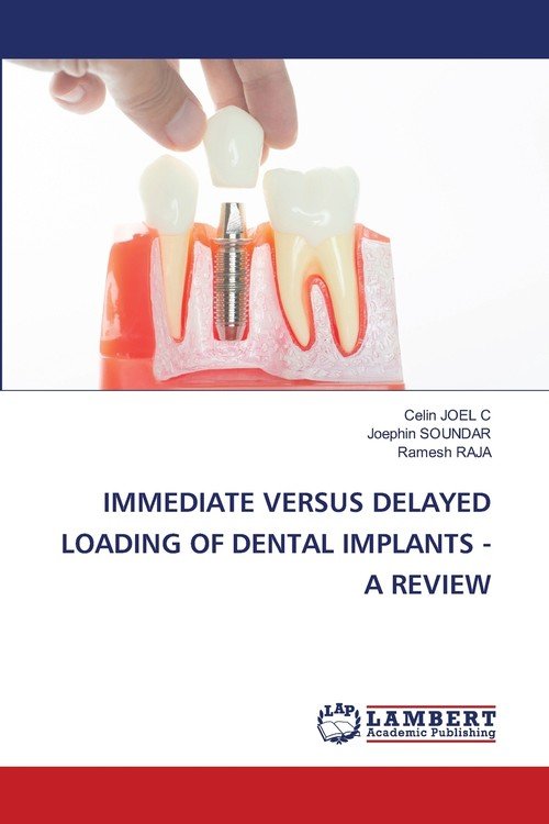 Immediate Versus Delayed Loading Of Dental Implants - A Review - JOEL C ...