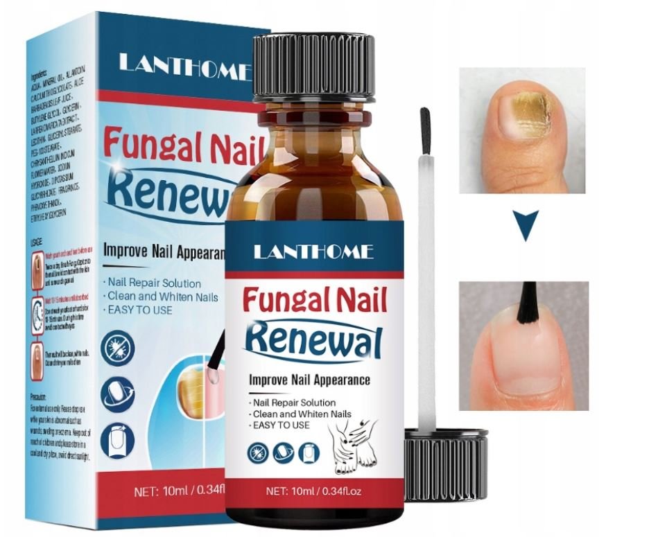 Lanthome, Grzybica paznokci Silny Płyn Do Naprawy Paznokci, 10ml ...