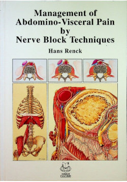 Management of Abdomino Visceral Pain by Nerve Block Techniques ...