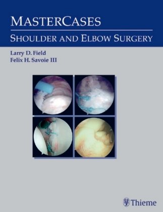 Master Cases, Shoulder and Elbow Surgery - Thieme, Stuttgart | Książka ...