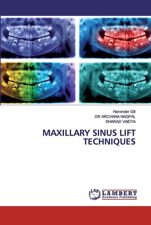 MAXILLARY SINUS LIFT TECHNIQUES - W opisie | Książka w Empik