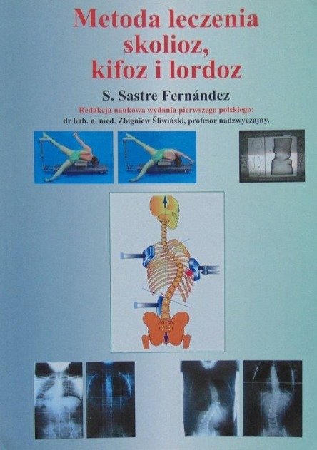 Metoda leczenia skolioz kifoz i lordoz - Opracowanie zbiorowe | Książka ...