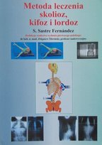 Metoda leczenia skolioz kifoz i lordoz - Opracowanie zbiorowe | Książka ...