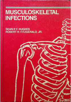 Musculoskeletal Infections - | Książka w Empik