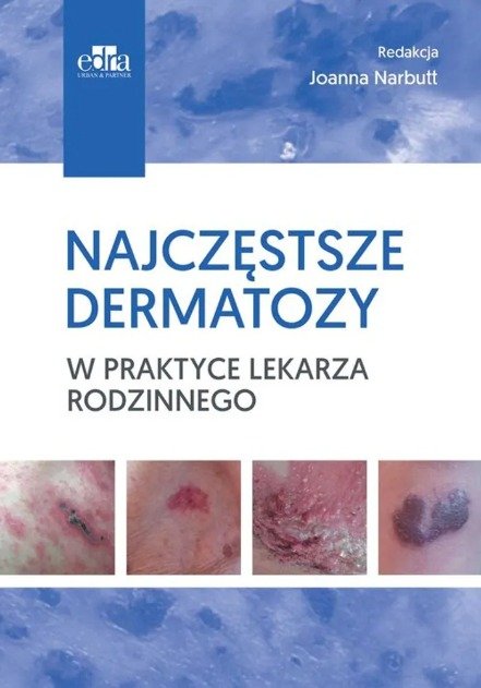 Najczęstsze dermatozy w praktyce lekarza rodzinnego - Opracowanie ...