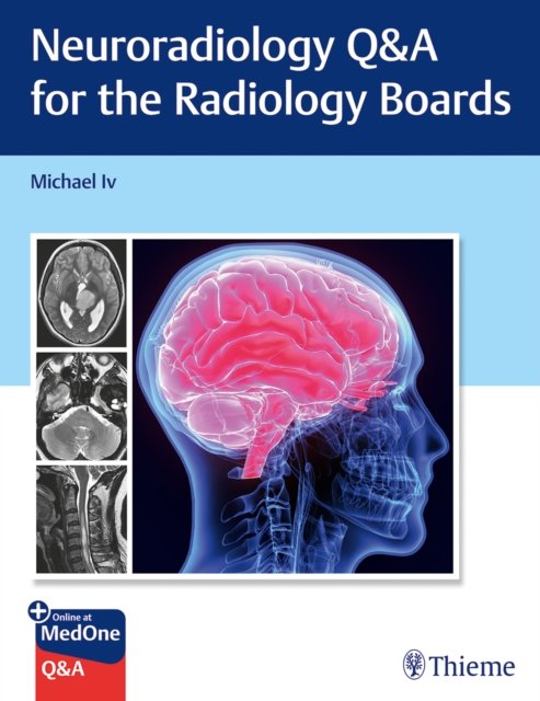 Neuroradiology Q&A for the Radiology Boards - Thieme Medical Publishers ...