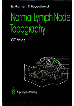 Normal Lymph Node Topography CT - Atlas - Opracowanie zbiorowe ...
