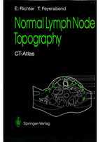 Normal Lymph Node Topography CT - Atlas - Opracowanie zbiorowe ...