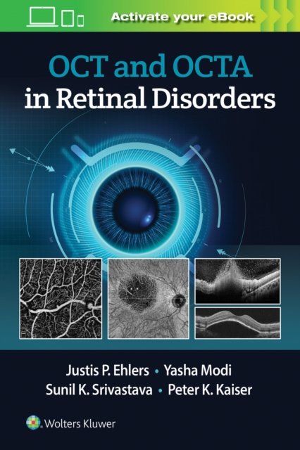 OCT and OCTA in Retinal Disorders - Justis P. Ehlers | Książka w Empik