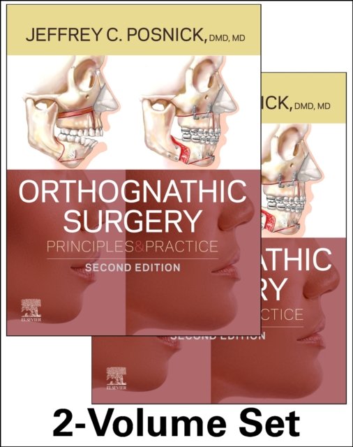 Orthognathic Surgery - 2 Volume Set: Principles and Practice - Jeffrey C. Posnick | Książka w Empik